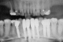 1000152554-1000260037 - Oral Health Group