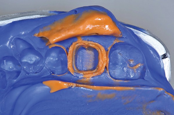 1001821169-1001821259 - Oral Health Group