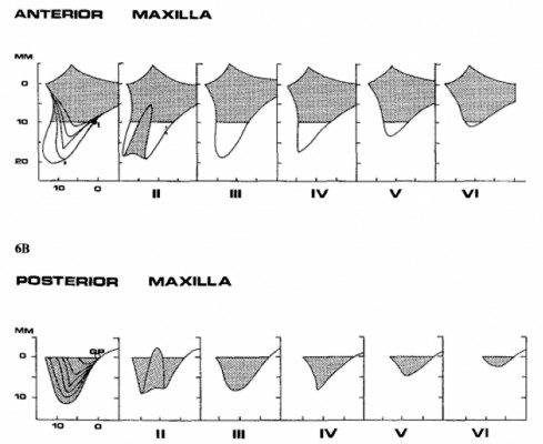 Zygomatic Implants For The Rehabilitation Of The Severely Atrophic ...