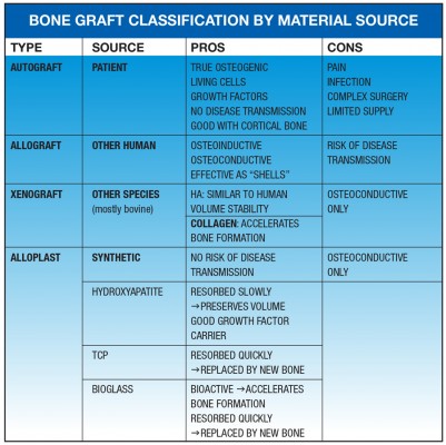 Bone Grafts For Implant Dentistry: The Basics - Oral Health Group