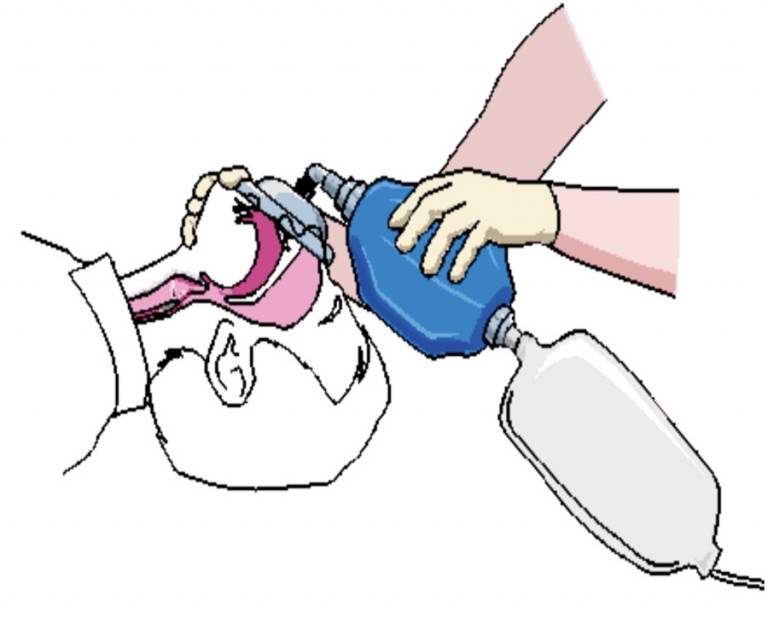 Oral Sedation in Pediatric Dentistry: The Growing Wave of Chemical ...