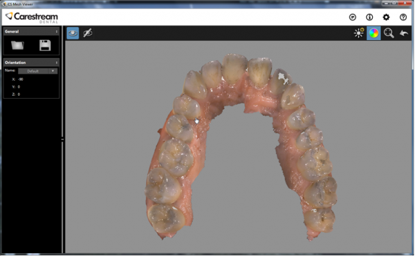 CS 3600 Intraoral Scanner - Oral Health Group