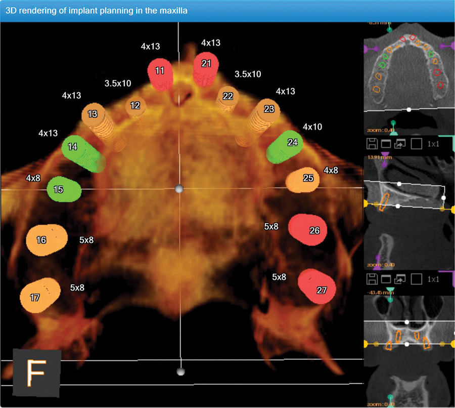 Naran image1 - Oral Health Group