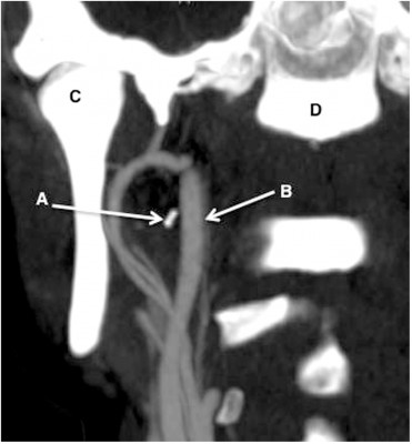 Cox Fig3 - Oral Health Group