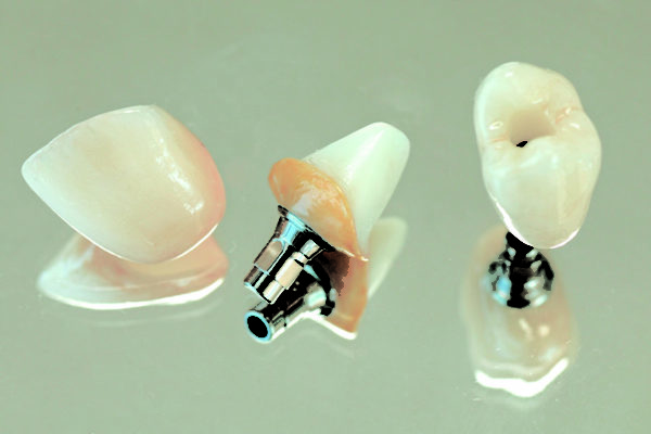 The Screwmentable - Oral Health Group