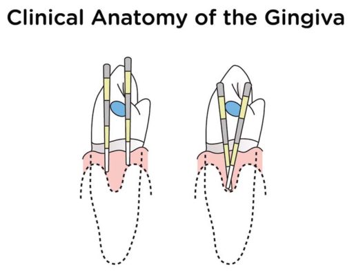 Gum Disease Starts Between the Teeth - Oral Health Group