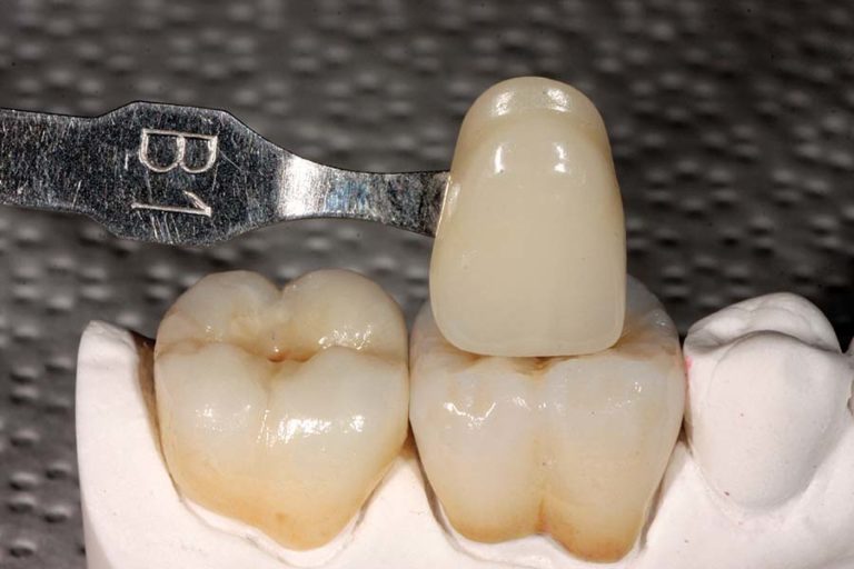 Quality Aesthetics in the Digital Age - Oral Health Group