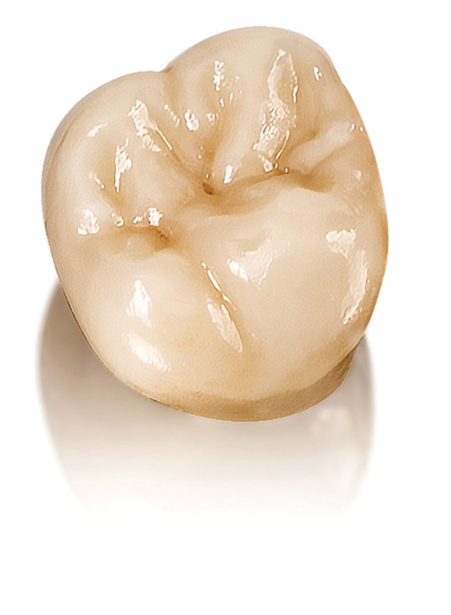 NOBELProcera_Crown - Oral Health Group