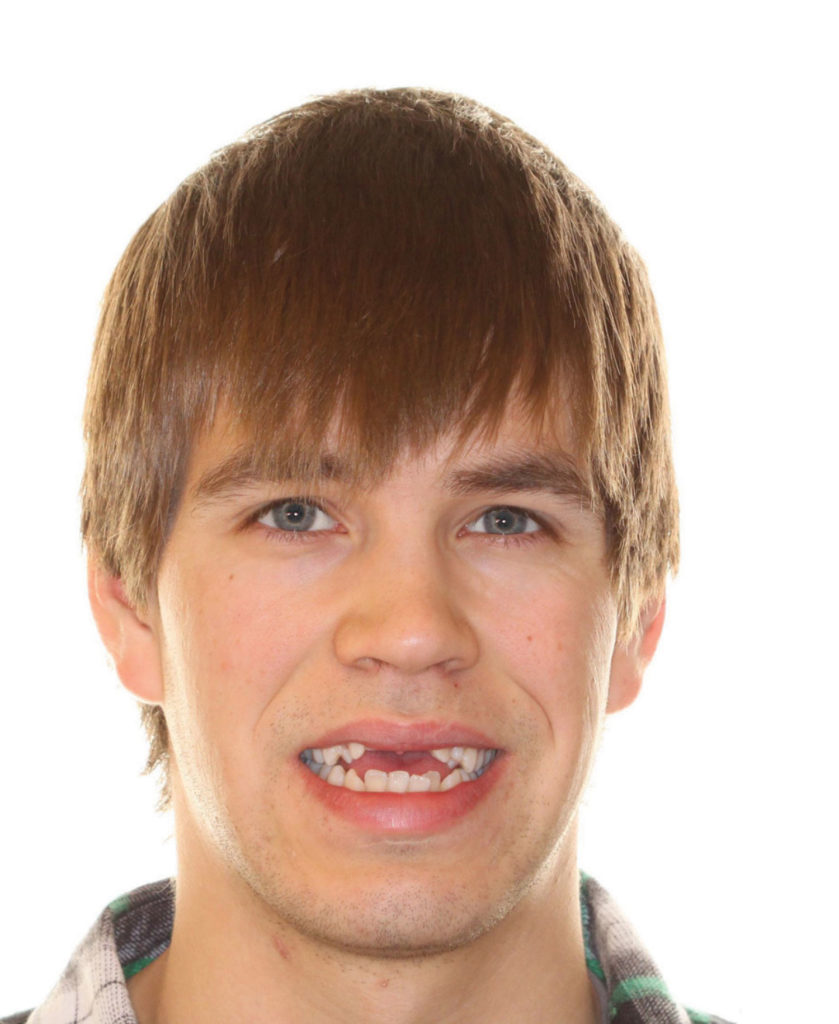 Advantages of Digital Smile Design: A Case Study - Oral Health Group