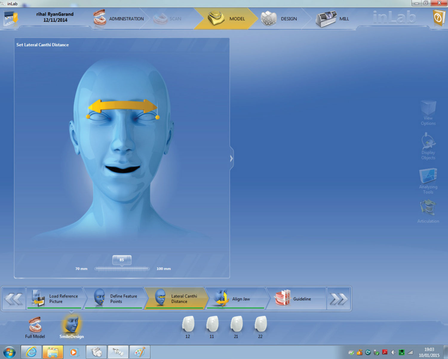 Advantages of Digital Smile Design: A Case Study - Oral Health Group