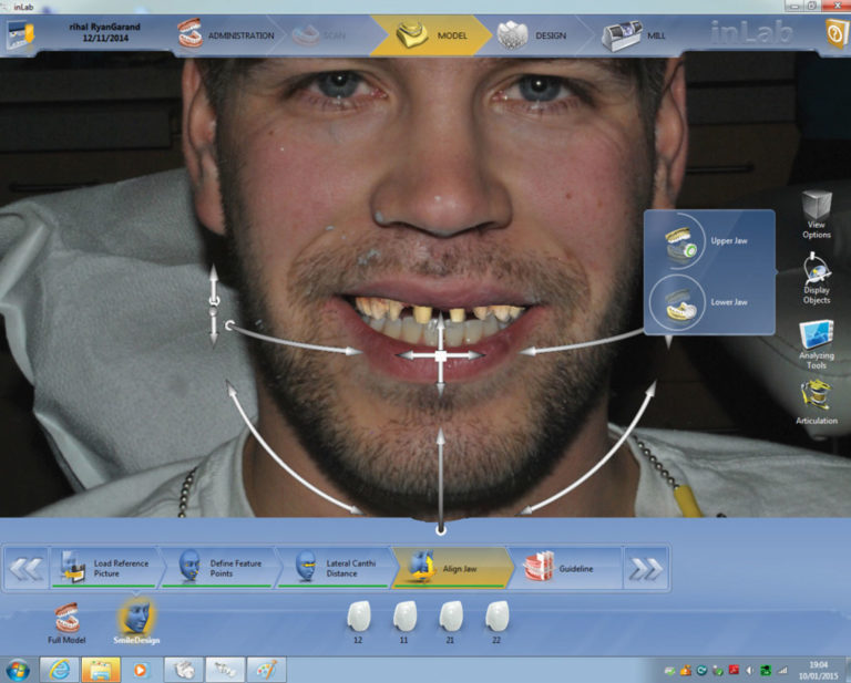 Advantages of Digital Smile Design: A Case Study - Oral Health Group