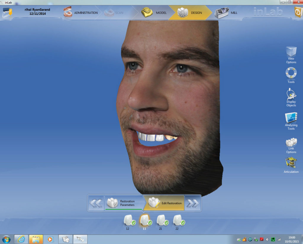 Advantages of Digital Smile Design: A Case Study - Oral Health Group