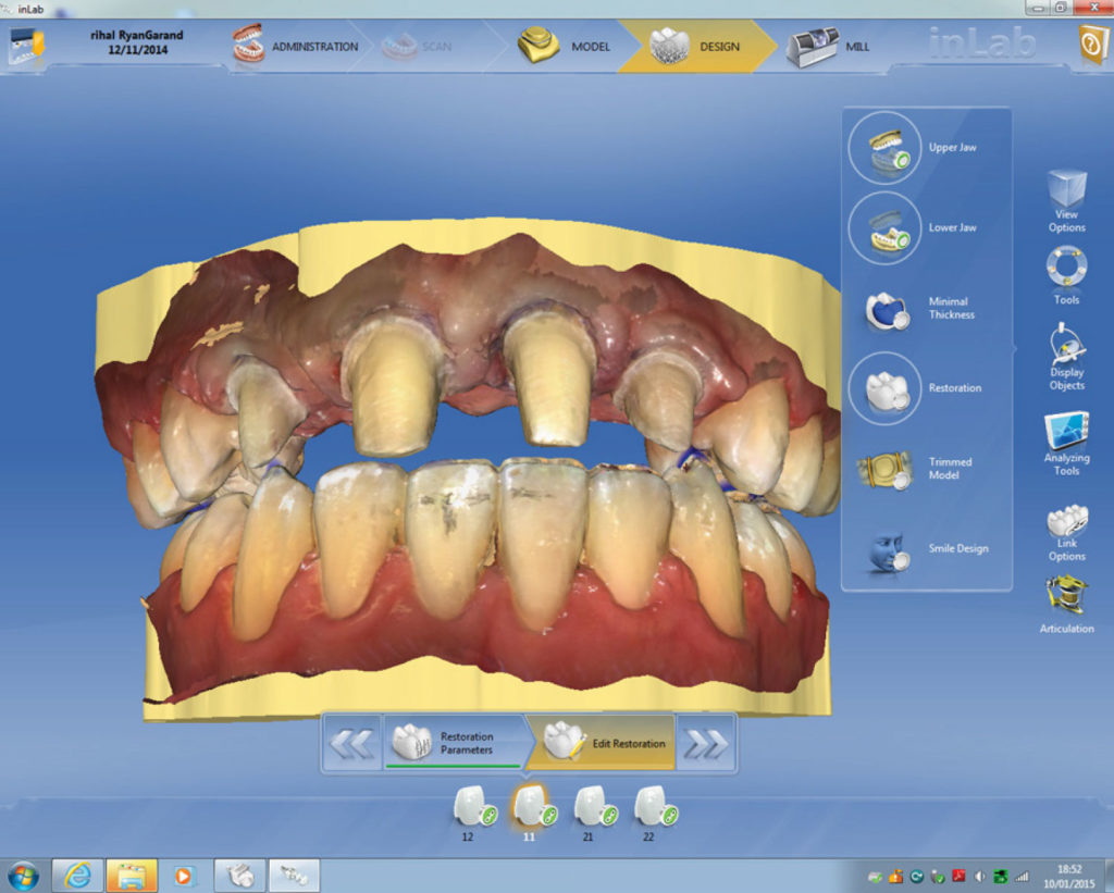 Advantages of Digital Smile Design: A Case Study - Oral Health Group