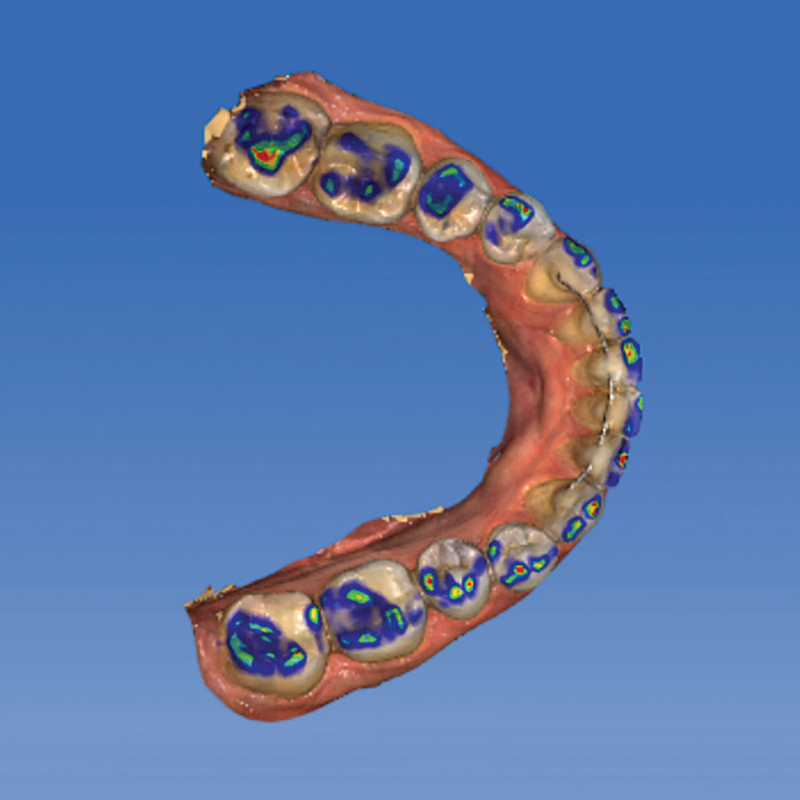 Digital Dentistry Series: Digital Orthodontics - Oral Health Group