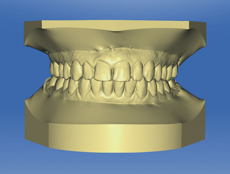 Digital Dentistry Series: Digital Orthodontics - Oral Health Group