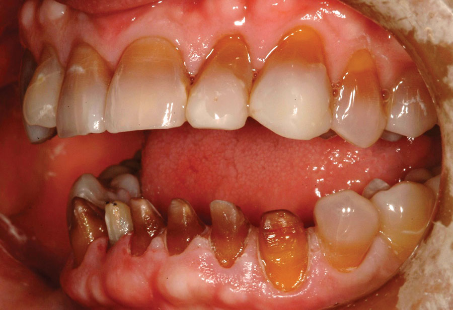 Resolving Colour and Crowding - Oral Health Group