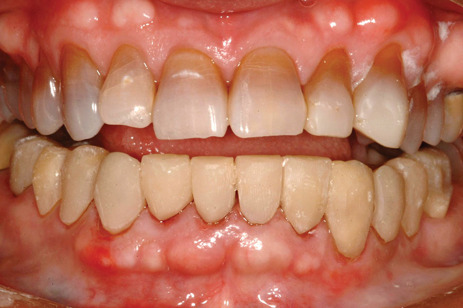 Resolving Colour and Crowding - Oral Health Group