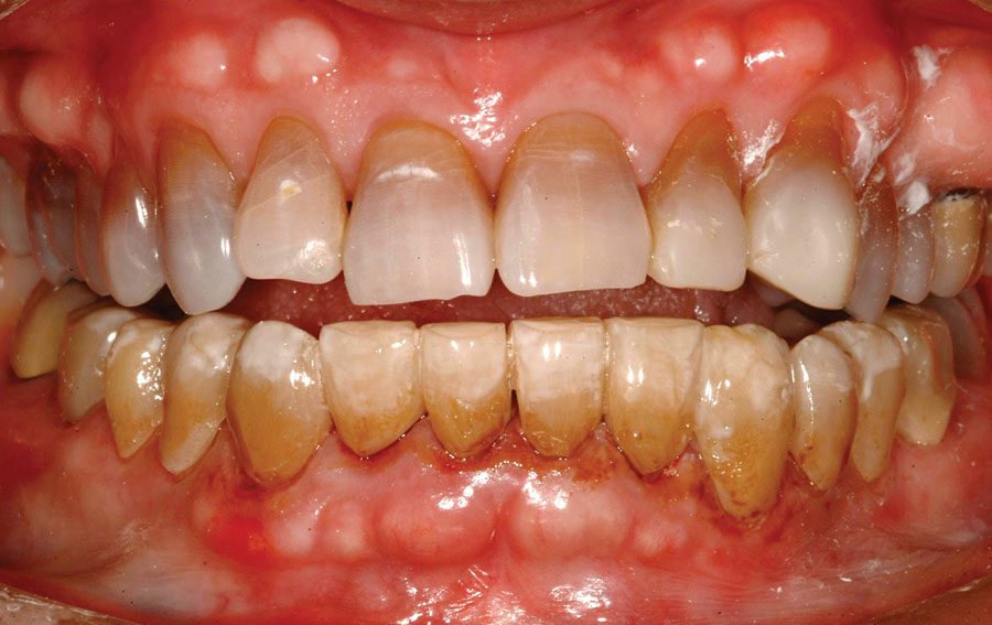 Resolving Colour and Crowding - Oral Health Group