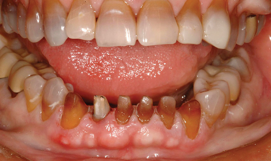 Resolving Colour and Crowding - Oral Health Group