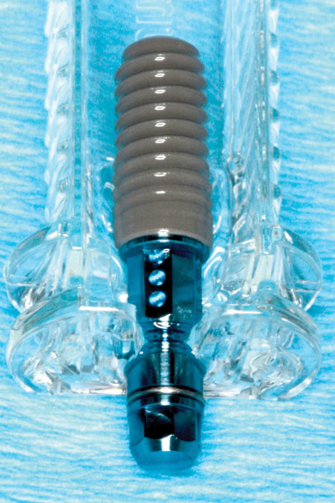 dabuleanu-26-straumann-roxolid-slactive-bone-level-implant - Oral ...