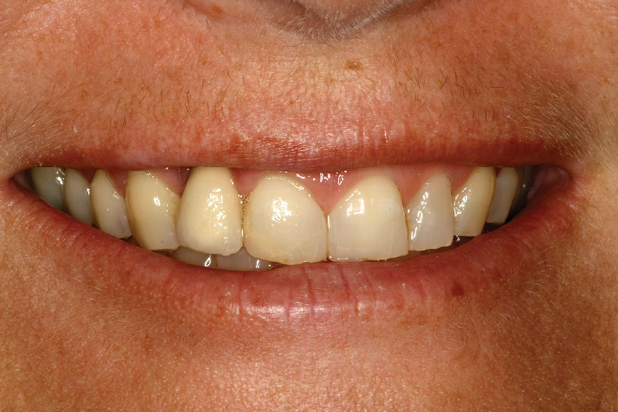 Case Report: The Titanium Smile - Oral Health Group