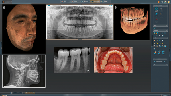 Sidexis 4 Receives German Design Award 2017 - Oral Health Group