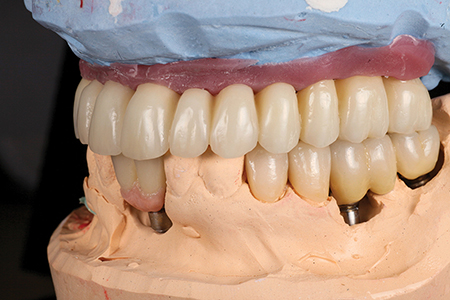 lin-17 - Oral Health Group