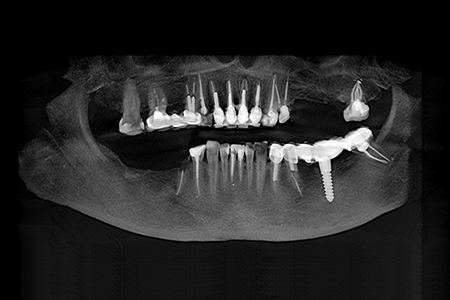 lin-2 - Oral Health Group