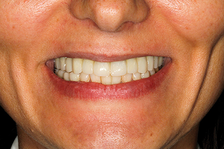 lin-6 - Oral Health Group