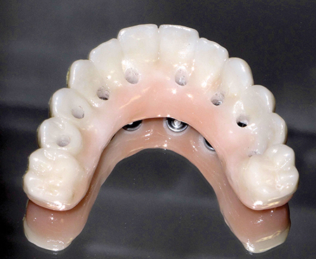Predictable Immediate Implant Prosthetics: Part 2 - Oral Health Group