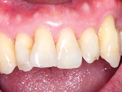 dunlap-image-7 - Oral Health Group