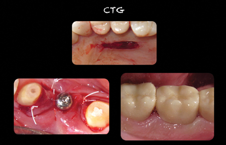 tawil-figure-7 - Oral Health Group