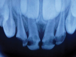 Aesthetic Restoration of the Primary Anterior Dentition - Oral Health Group