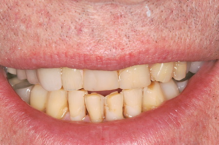 Overcoming Deficiencies to Create an Aesthetic Smile: A Case Study