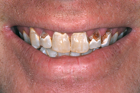 Beyond the Teeth - Oral Health Group