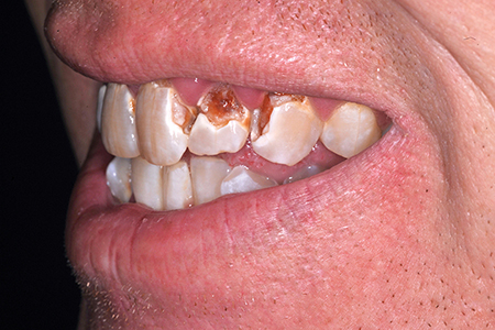 Beyond the Teeth - Oral Health Group