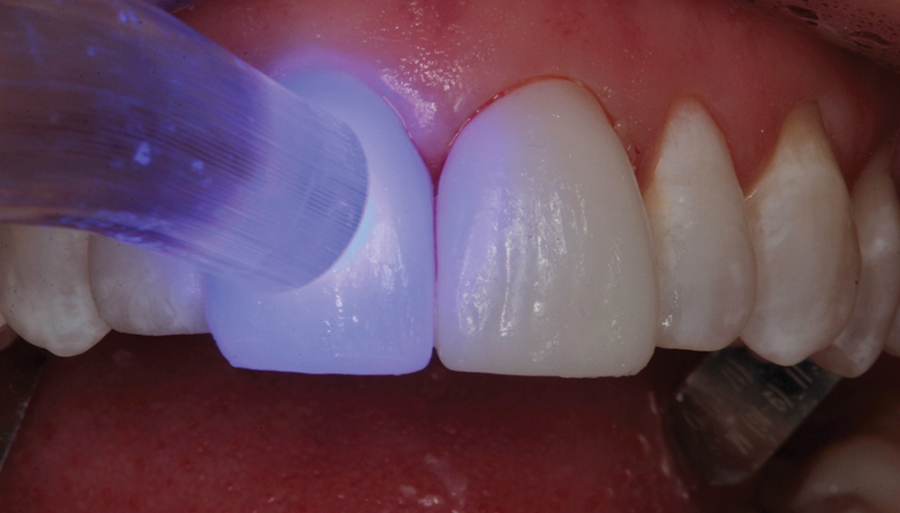 Nash 21 - Oral Health Group