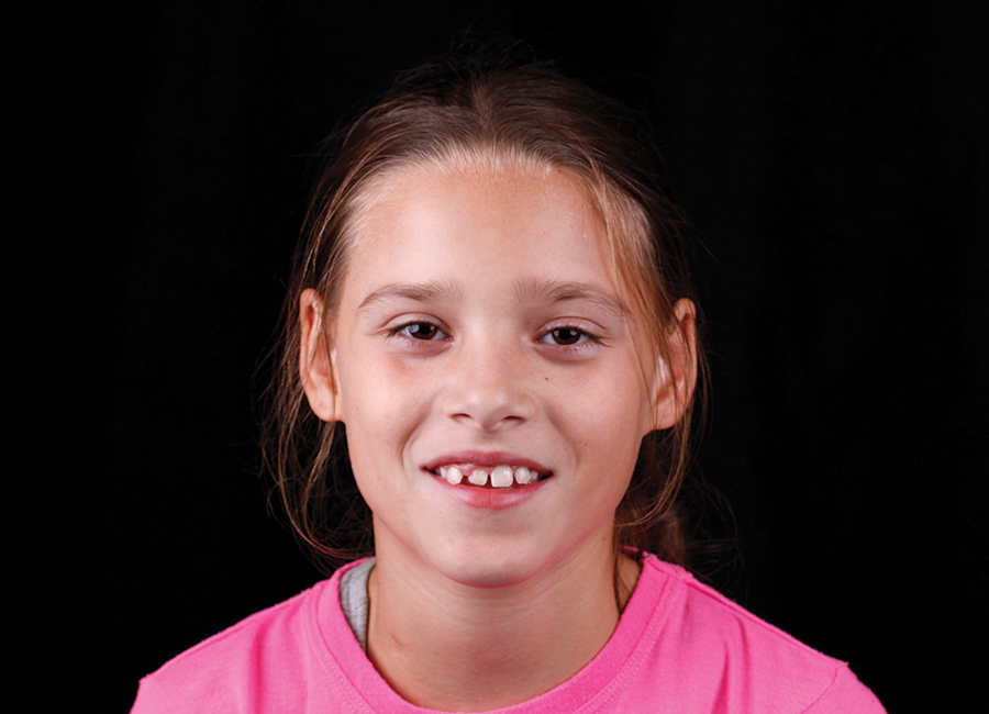 Esthetics and the Mixed Dentition - A Responsible Solution