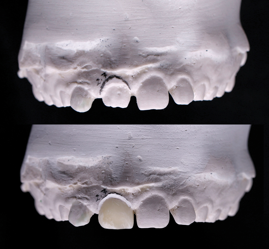 Esthetics and the Mixed Dentition - A Responsible Solution