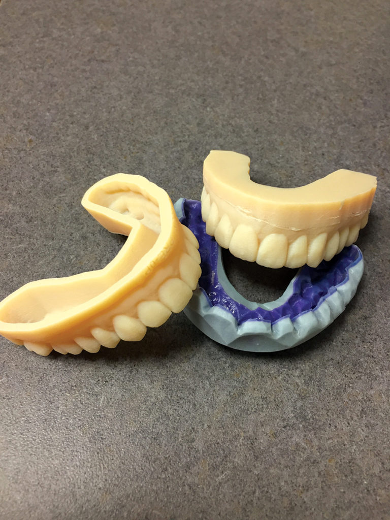 The Use of Digital Smile Design for Everyday Dentistry - Oral Health Group