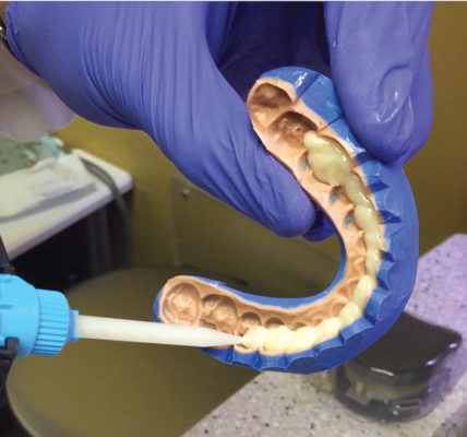 The Use of Digital Smile Design for Everyday Dentistry - Oral Health Group