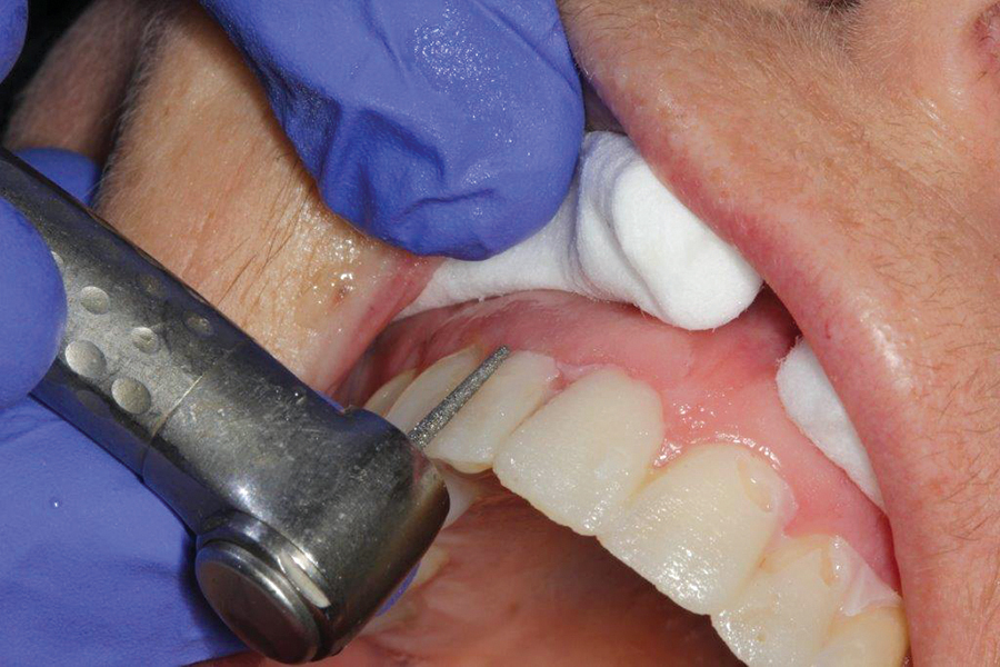 Shah Figure 9 - Oral Health Group