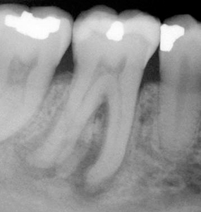 Ni-Ti Goes Gold "Ten Clinical Distinctions" - Oral Health Group