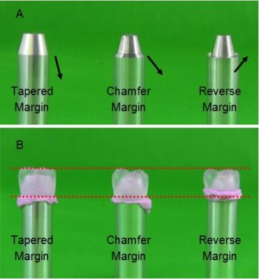 Controlling Excess Cement During the Process of Intra-Oral Prosthesis ...