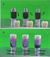 Controlling Excess Cement During the Process of Intra-Oral Prosthesis ...