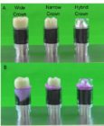 Controlling Excess Cement During the Process of Intra-Oral Prosthesis ...
