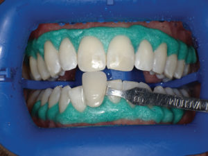 SHOFU DENTAL DIGITAL CAMERA - Oral Health Group