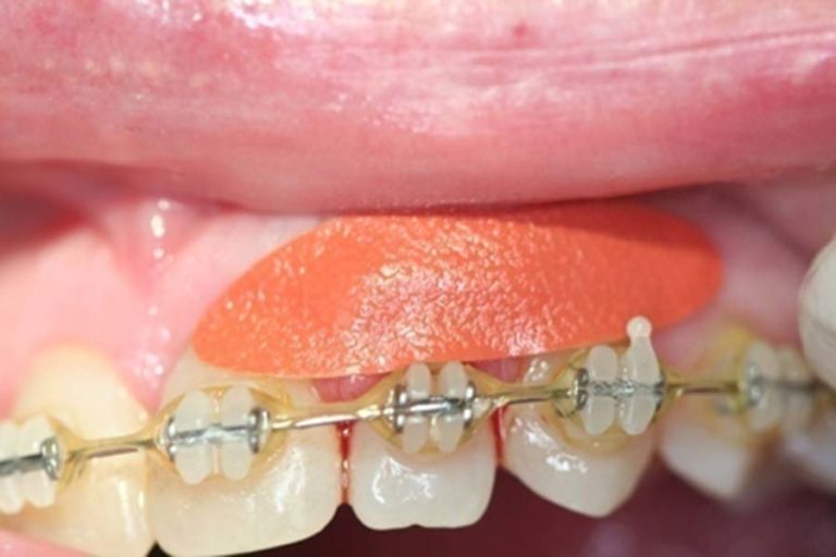 Empowering Periodontal Therapy - Oral Health Group