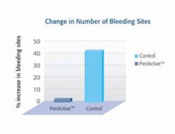 Alternative Rinses: Moving Away From Chlorhexadine - Oral Health Group