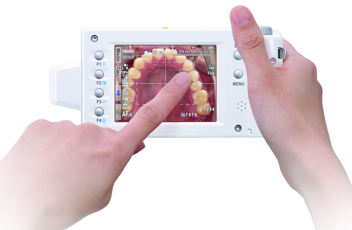 Digital Dental Photography for the Entire Dental Team - Oral Health Group